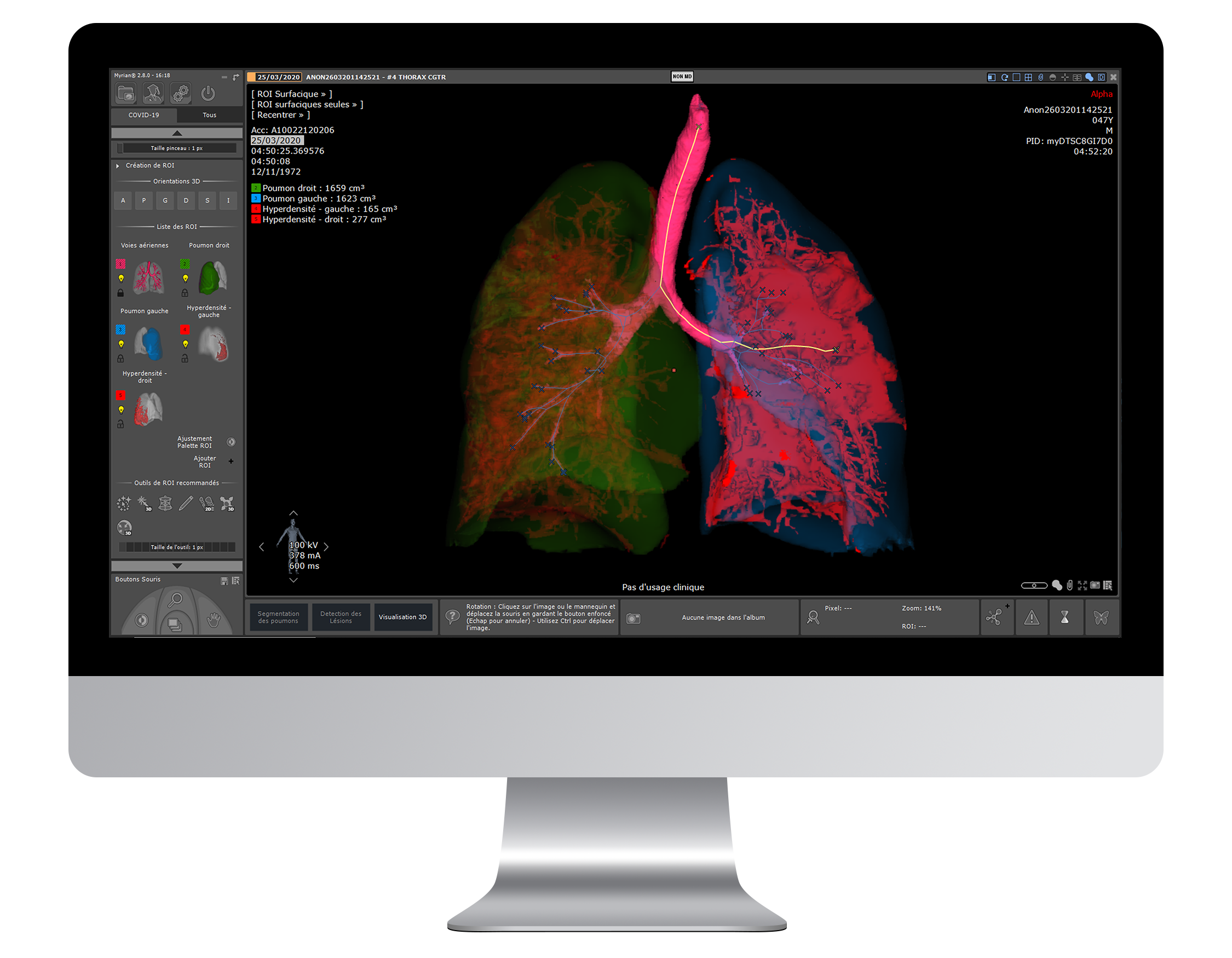 Myrian® COVID-19 Protocol - Intrasense-Artificial Intelligence in ...
